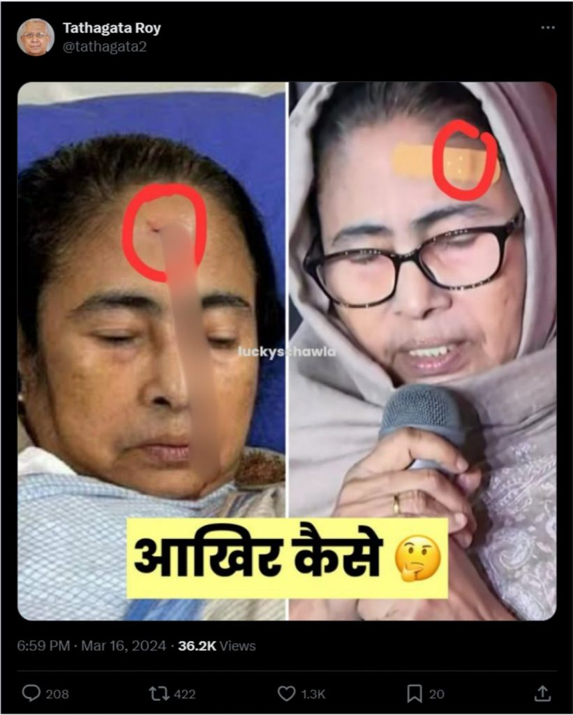 Mamata Banerjee's injury: Old photo shared in a collage to mock Bengal CM - Alt News